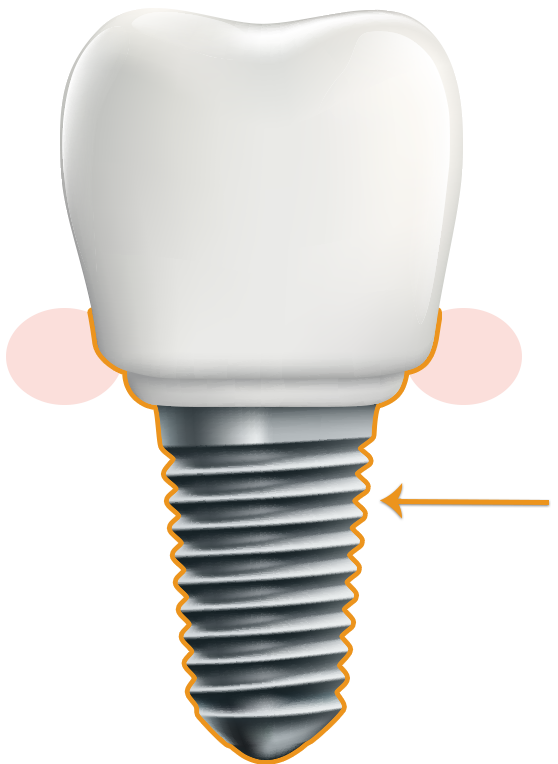 Periodontist in New Port Richey & Tampa | Periodontal Health Center