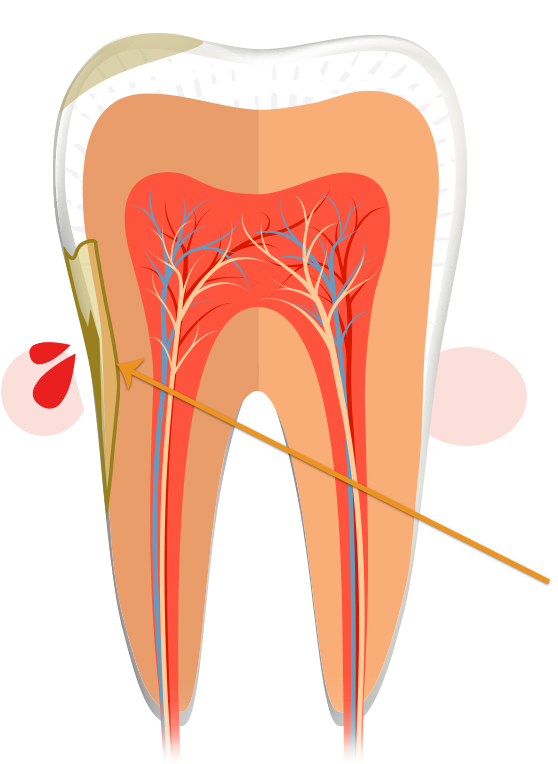 Periodontist in New Port Richey & Tampa | Periodontal Health Center